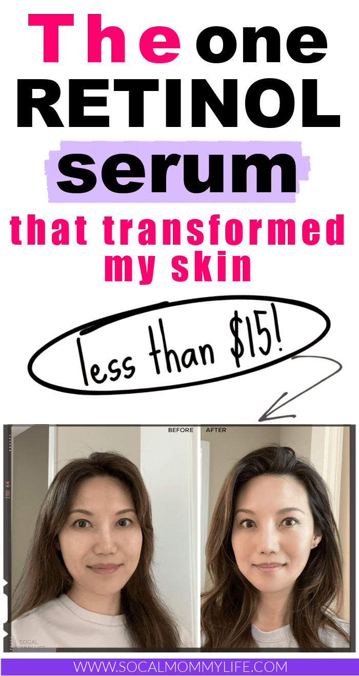 The Ordinary Retinol Review | The Serum That Changed My Life - SoCal ...
